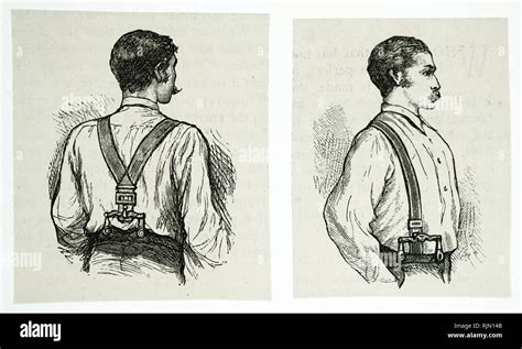 Illustration Showing Adjustable Braces With Cross Tree Fitment