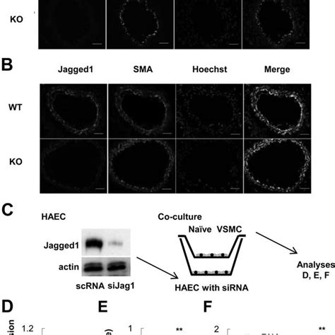 Overexpression Of Endothelial Cell Jagged1 Induced Vascular Smooth