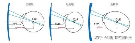 谈一谈蔡司的精密成型技术， 知乎