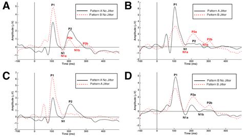 stimulus specific cortical visual evoked potential morphological patterns