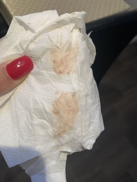 5 Weeks Spotting Terrified Warning Photo Attached Mumsnet