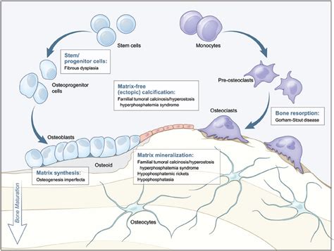 Rare Skeletal Diseases