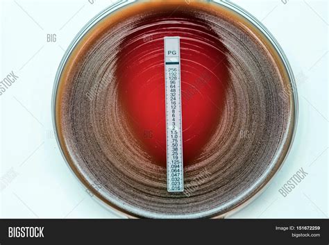 E Test Penicillin Image And Photo Free Trial Bigstock