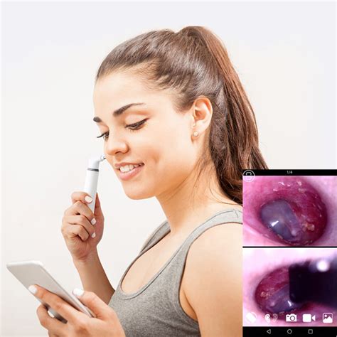 5 In1 Earscope Cleaner Wifi Ear Endoscope Camrea 1080p Ear Spoon