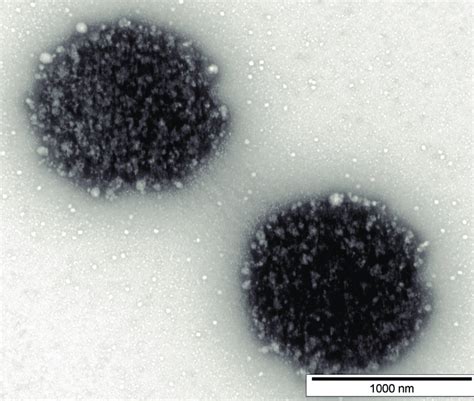 3 Transmission Electron Microscope Picture Of Globular Structures Download Scientific Diagram