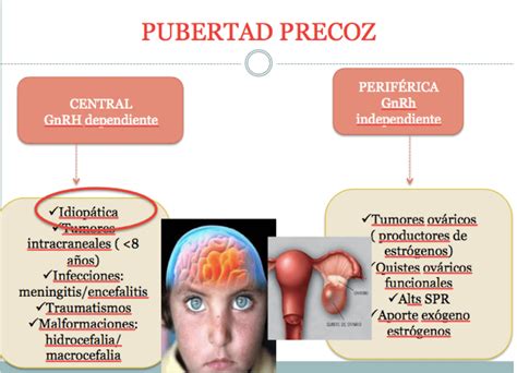 Pubertad Precoz En Los Bebés La Pubertad Precoz En Niñas Aumentó