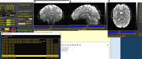 Problem At Volreg Step Using Afni Proc Py AFNI Message Board AFNI