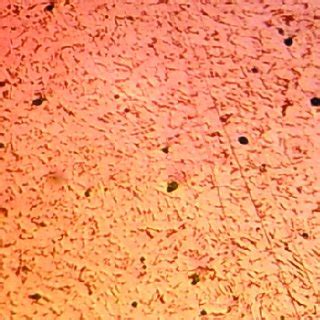 Microstructure Of Sample No 1 A Weld Zone 100X B Fusion Boundary