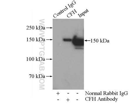 Complement factor H Rabbit anti Human Polyclonal Proteintech μL Unconjugated Fisher