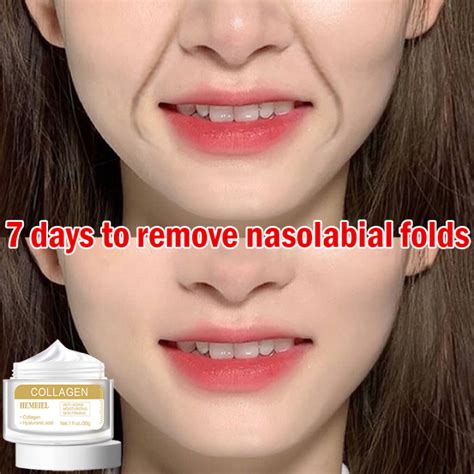 Hemeiel Wrinkle Fine Lines Remover Facial Tightening Creamremove