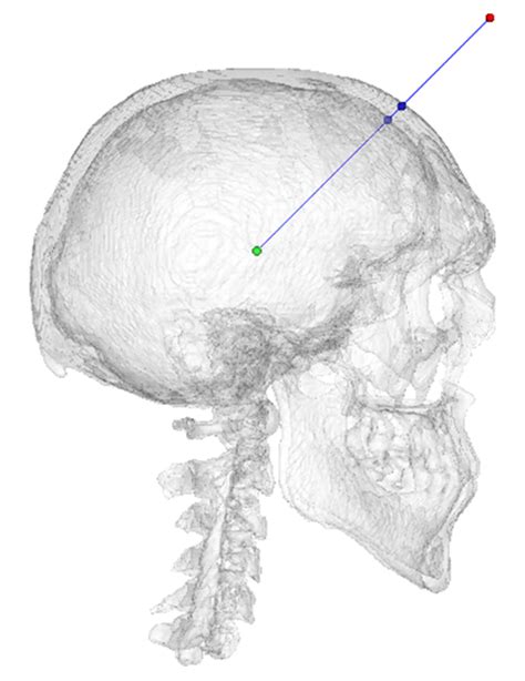 Ray Casting And Ray Tracing With Vtk