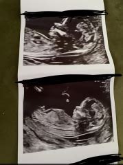 Guess The Sex Mumsnet