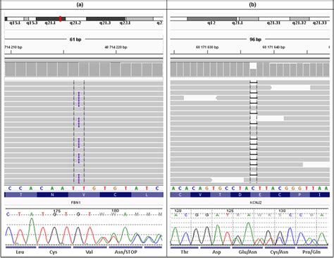 Igv Snapshot And Sanger Sequencing Confirmation Of Variants A