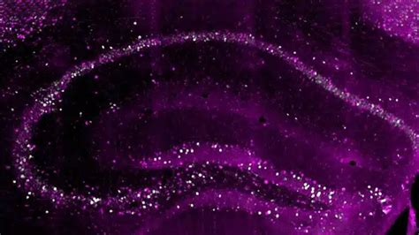 How Human Brain Makes Memories And Store It Health Dunya News