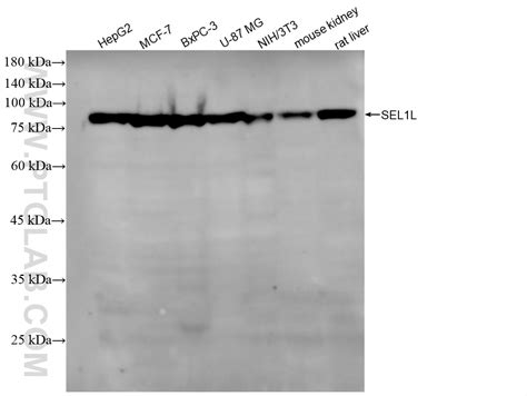 Sel1l Antibody 84317 7 Rr Proteintech
