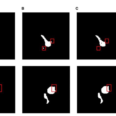 Sample Segmentation Effect Of MRI Images A Real Label B