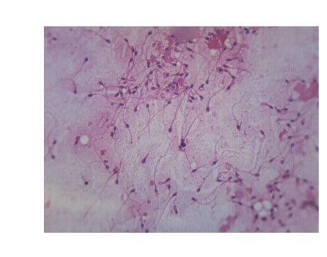 Human Sperm Smear Prepared Microscope Slide 75x25mm Klm Bio