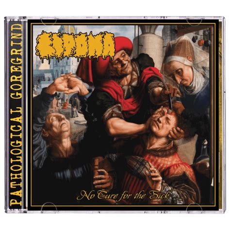 Lipoma Seizure Stomp Aesthetic Principles Of Reconstructive Surgery