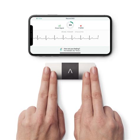 Customer Reviews Alivecor Kardiamobile 6l Personal Ekg Monitor Black