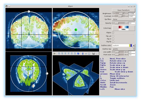 Alignments — Pycortex 1211 Documentation