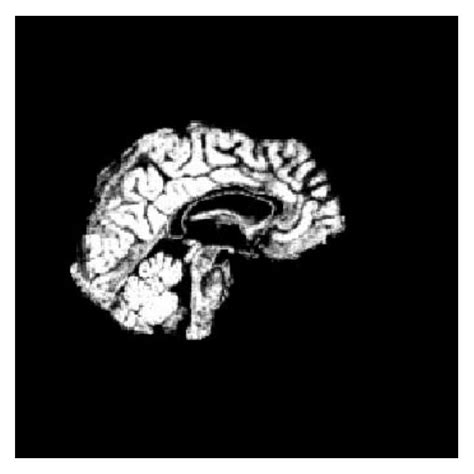 Segmentation Results Gray Matter By The Proposed Method A