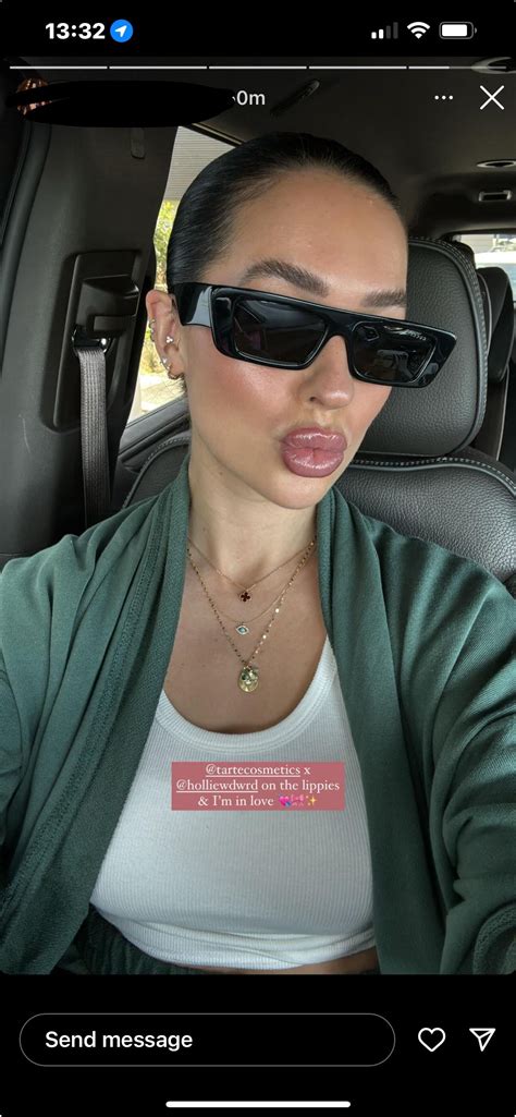 Hemorrhoid Butthole Lips Raverywoodssnark