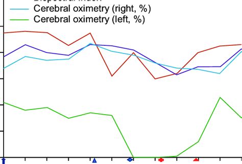 Mean Arterial Pressure Bispectral Index Cerebral Oximeter Value