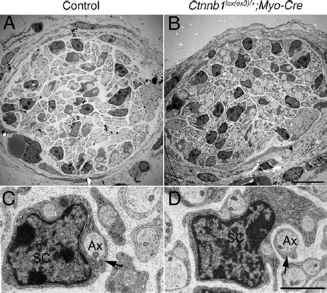 B Catenin Stabilization In Muscles Leads To An Increase In Motor Axon