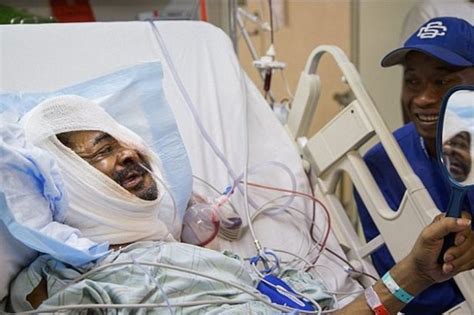 Homem tem tumor gigante quase kg retirado do rosto após andar dias para pedir ajuda