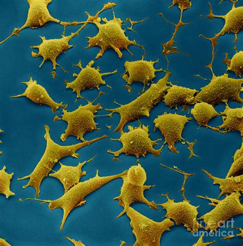 Human Fibroblast Cells Photograph By David M Phillips Fine Art America