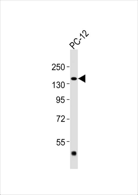 Ihc Plus™ Adcy5 Adenylate Cyclase 5 Polyclonal Antibody Rabbit Lsbio