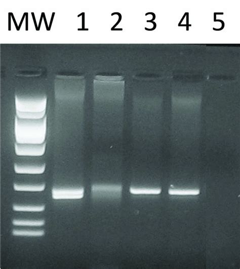 Clonality Analysis Of T Cell Receptor Gamma Chain Gene By Pcr Showing A Download Scientific
