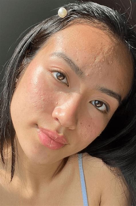 30 Best Korean Skincare Products For Acne Prone Skin Natalie Oneill