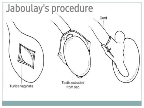 Surgery Operative Procedures 1 Pptx
