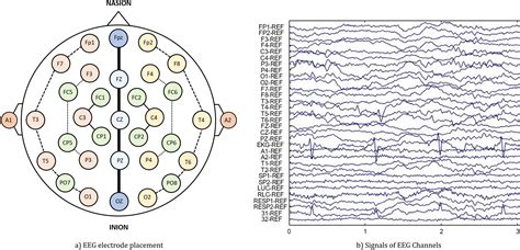 Investigating Population Specific Epilepsy Detection From Noisy Eeg