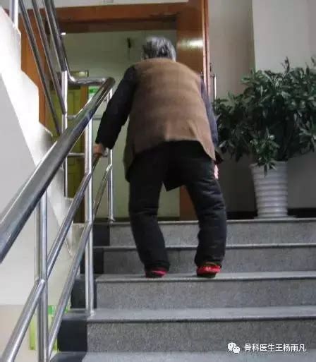 膝关节长骨刺怎么办别再盯着骨刺不放了 知乎