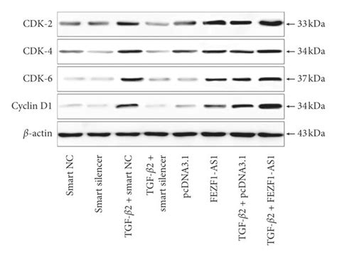 Fezf1 As1 Promotes Tgf β2 Induced Sra0104 Cell Proliferation A