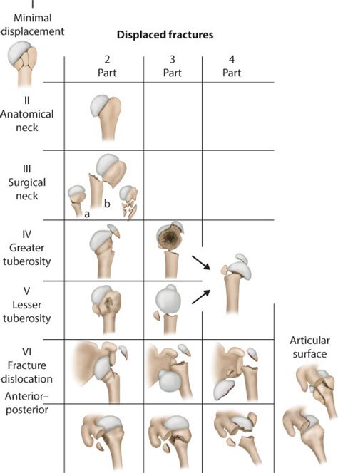 Ortho Case More Than Just A Shoulder Dislocation — Kwak Talk