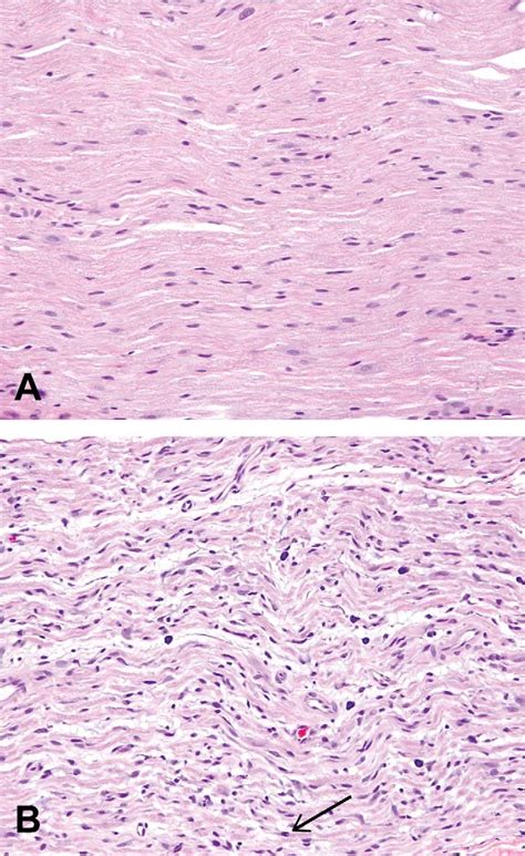 Sciatic Nerve From Rats Treated Orally For Seven Consecutive Days With Download Scientific