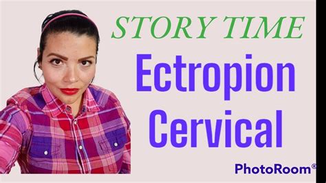 Ectropion Cervical Story Time Mi Experiencia 😱 Youtube