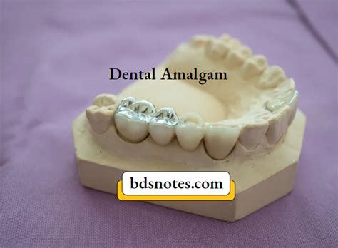 Dental Amalgam Bds Notes