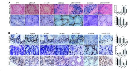 Cellular Senescence Proliferation And Apoptosis Occurred In Tissues