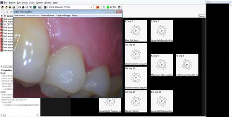 Mipacs Mouthwatch Help Center