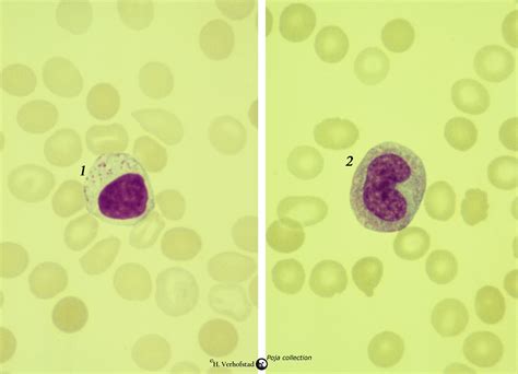 Lymphocyte Vs Monocyte