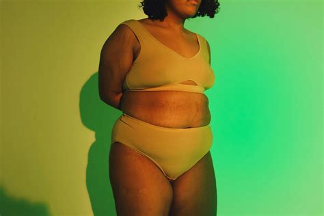 How To Prepare For Your Inkless Stretch Mark Revision Treatment