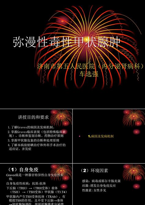弥漫性毒性甲状腺肿 车选强ppt卡卡办公