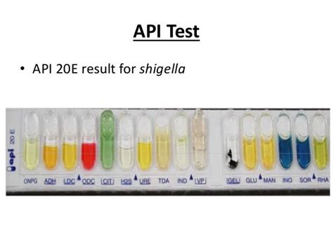 Shigella