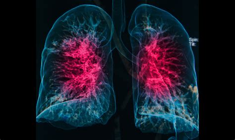 Spirometry Reference Values In Indigenous Australians A Systematic Review The Medical Journal