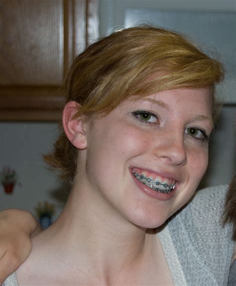 Pin Op Braces In 2024