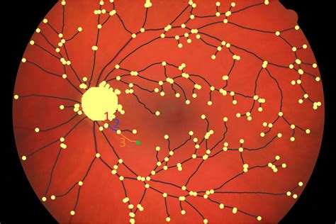 Segmentation Example Example Result Of The Automatic Segmentation Download Scientific Diagram